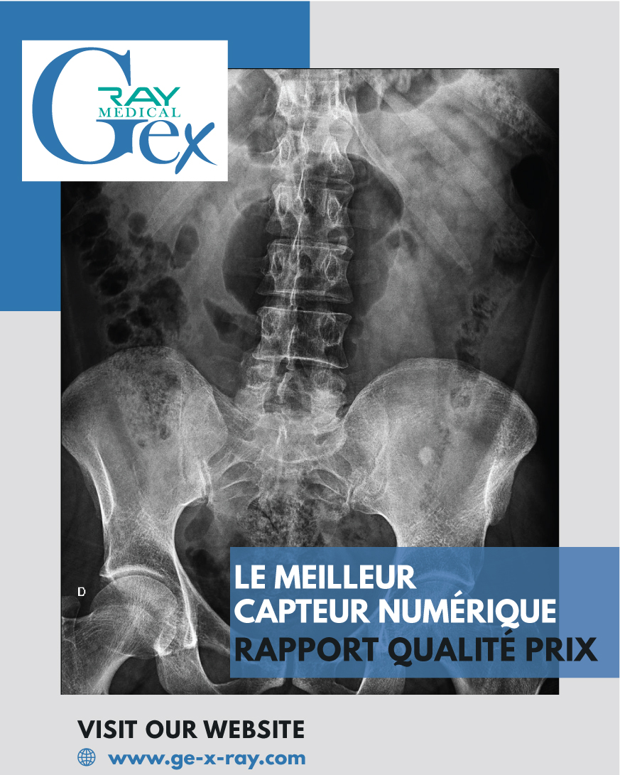 Installation d'un capteur plan numérique | ge-x-ray-medical.com